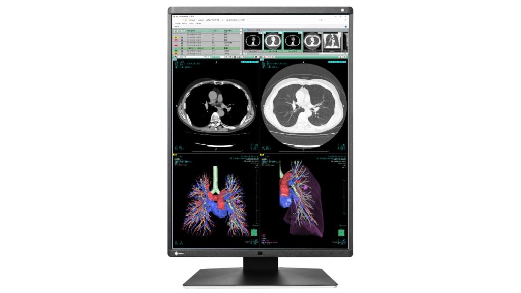 Eizo RadiForce RX370 - Divicon Oy